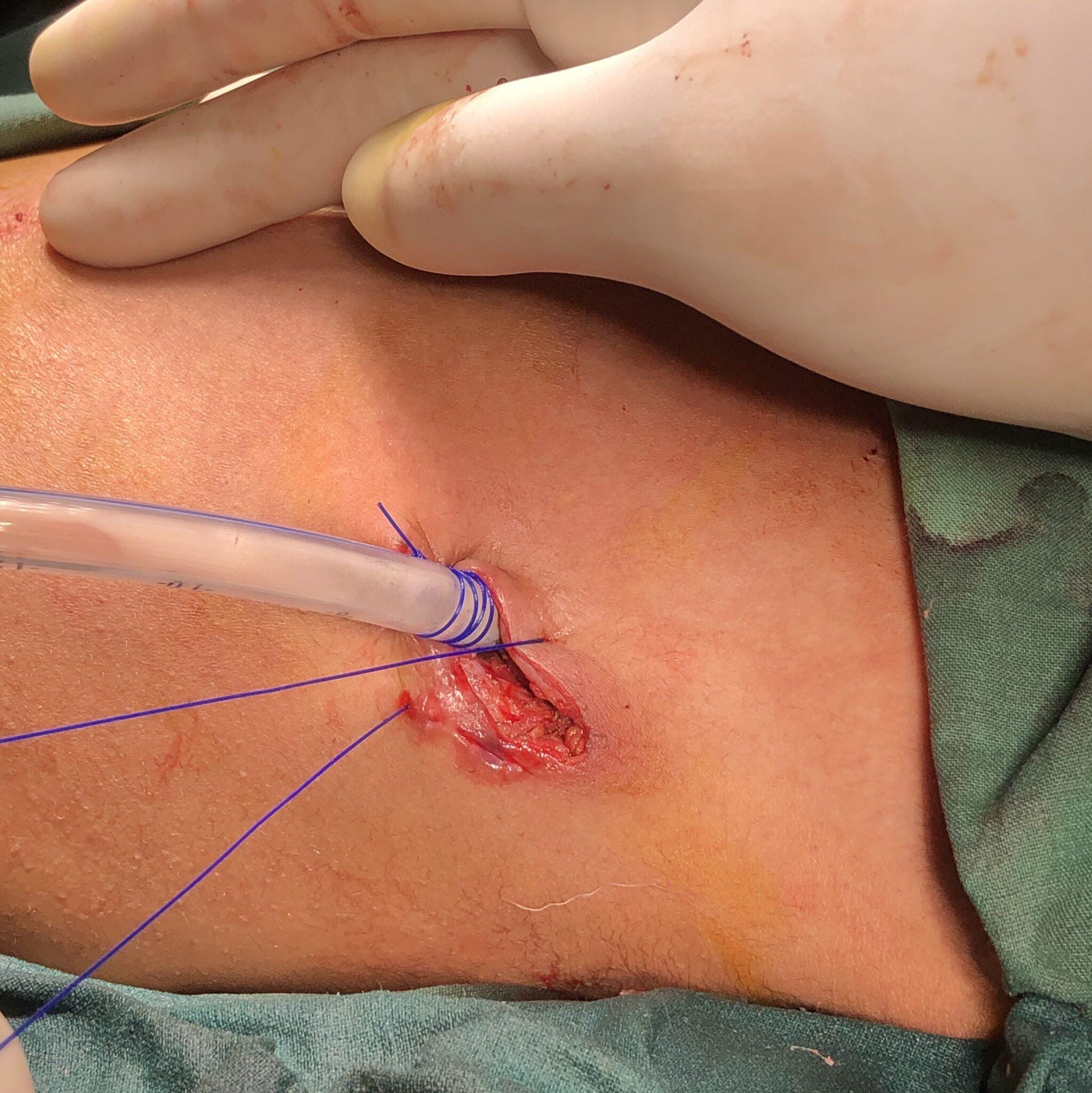 SurGide - The Surgical Guide